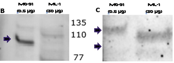 MO-91 Acute Myeloid Leukemia w Minimal Differentiation Human Cell Line ...
